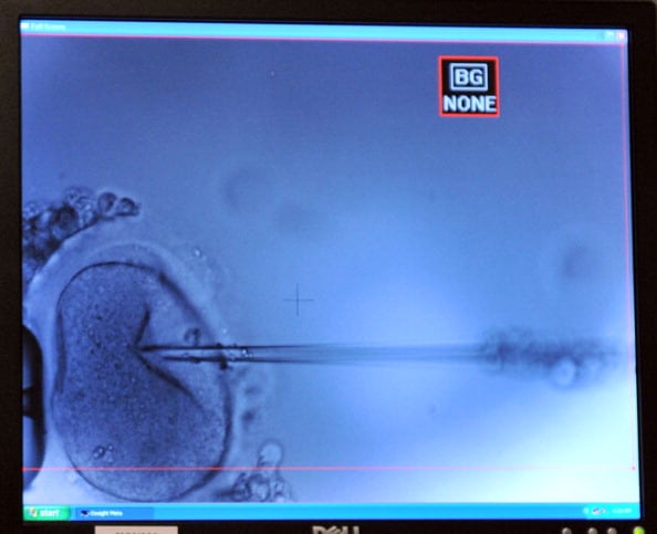 Eterologa: Italia costretta a "importare" gameti dall'estero per ...