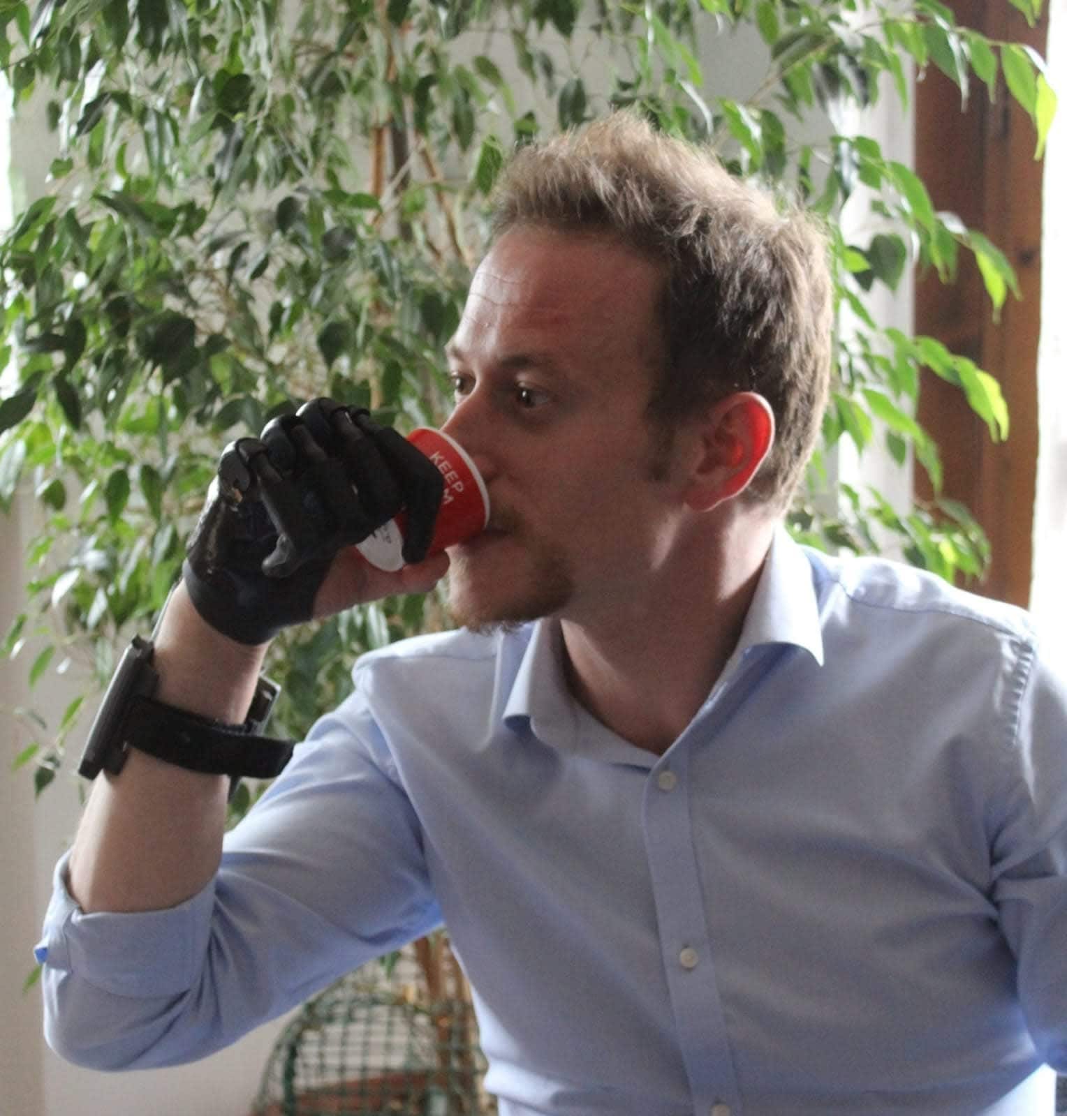 Marco Bucci e la sua mano robot: "Sono bionico, come sognano i bambini"