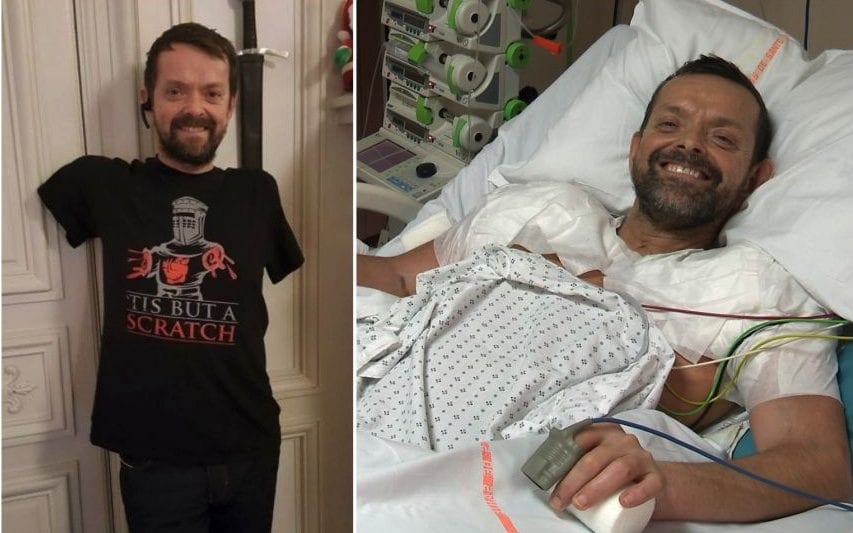 Perde entrambe le braccia in incidente al lavoro, con trapianto record ...