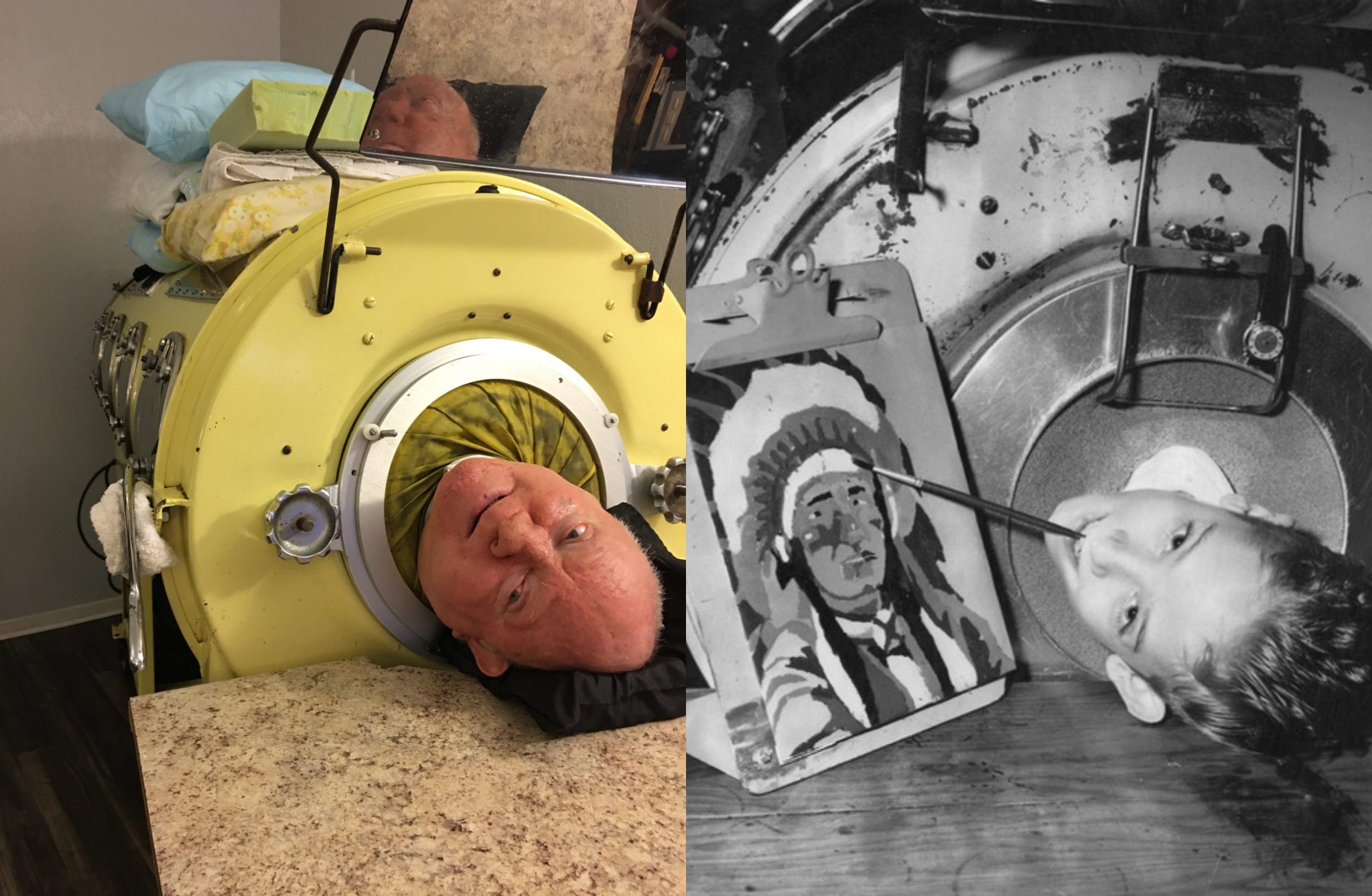 Come Paul Alexander ha vissuto nel polmone d'acciaio: il racconto del ...