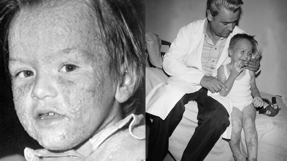 Disastro di Seveso, 1976: la nube tossica che cambiò l’Italia per sempre