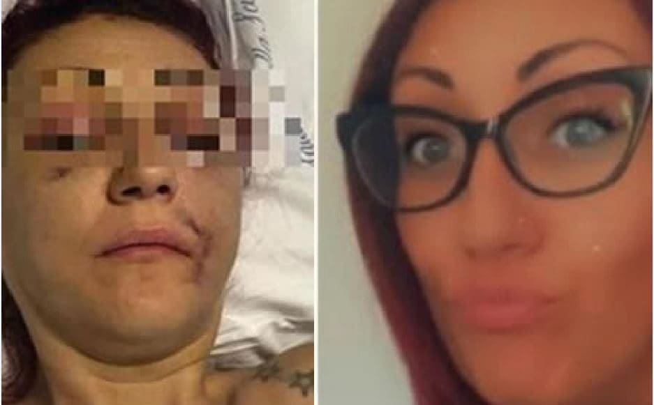 Lucia Regna, l'ex marito non va in carcere: la massacrò di botte e la ...