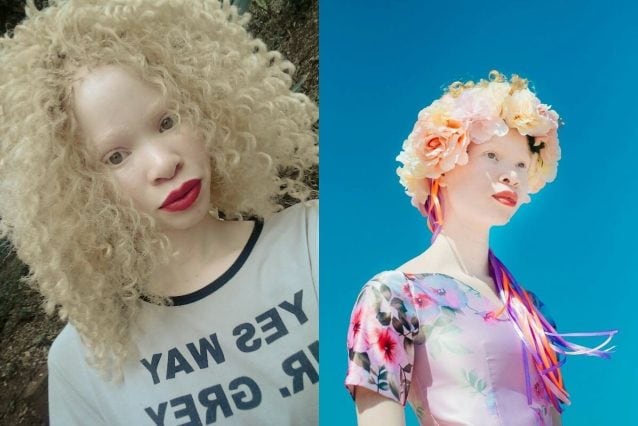 La chiamavano "fantasma" perché albina, oggi ha realizzato il suo sogno ...