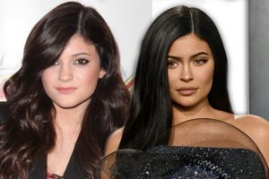 I peggiori seni rifatti delle star (FOTO)