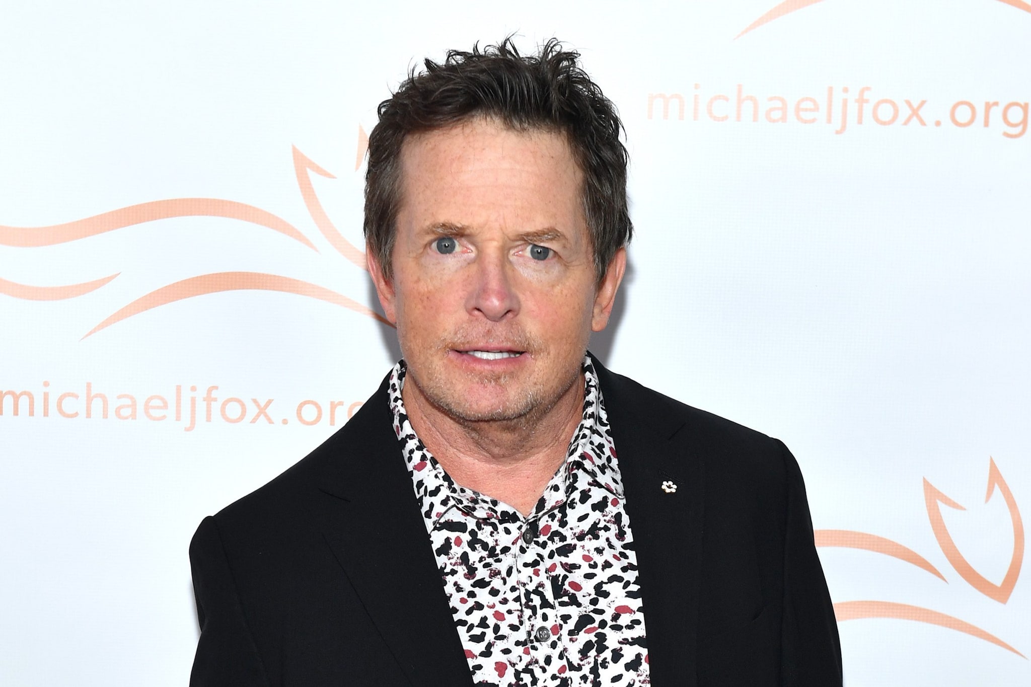 Michael J. Fox e il Parkinson: "La mia carriera da attore è finita"
