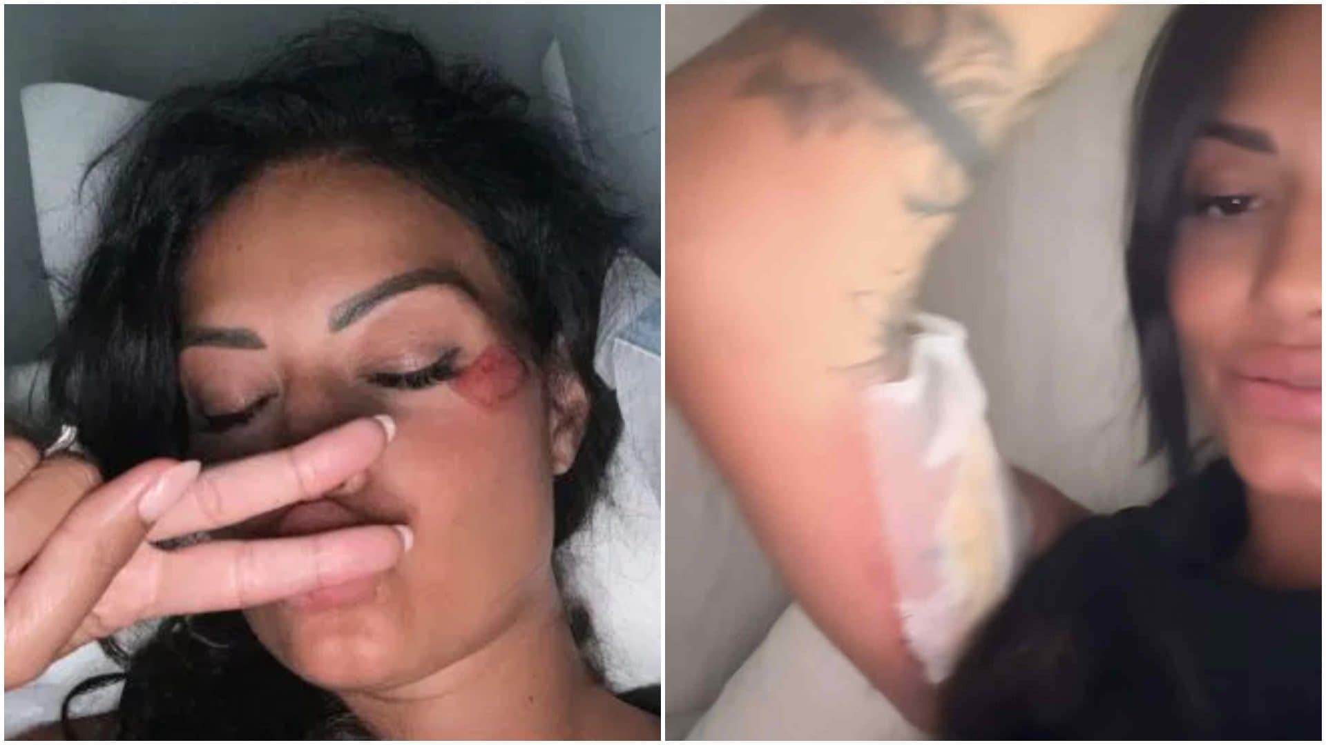 Paura per Alessia Pascarella, investita l'ex concorrente di Temptation ...