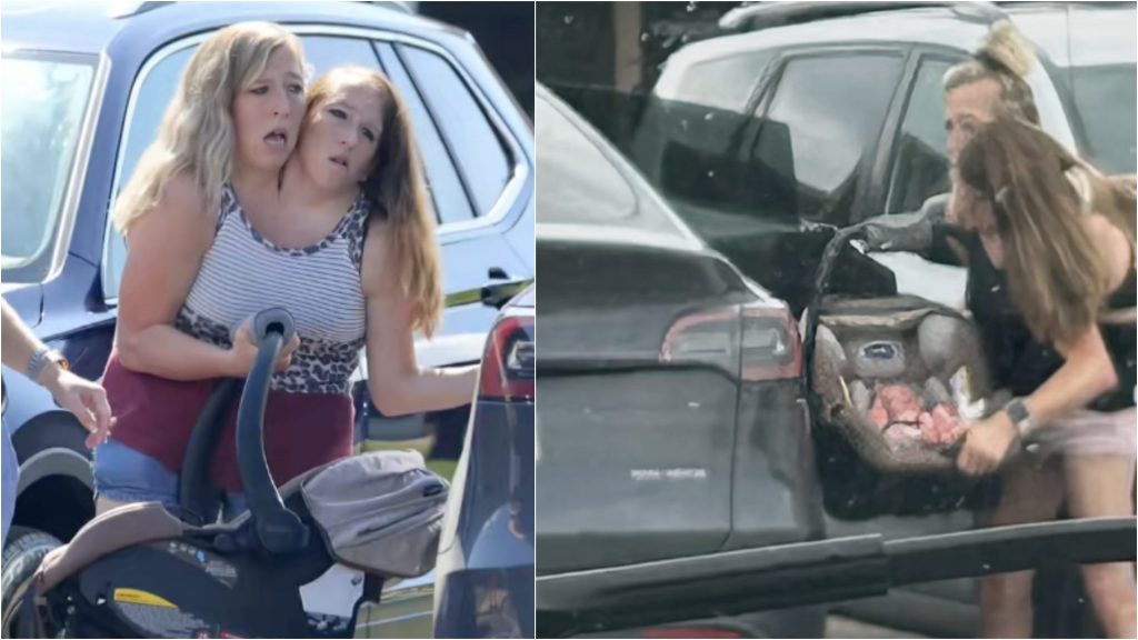 Le gemelle siamesi Abby e Brittany Hensel hanno avuto un bambino: ecco ...