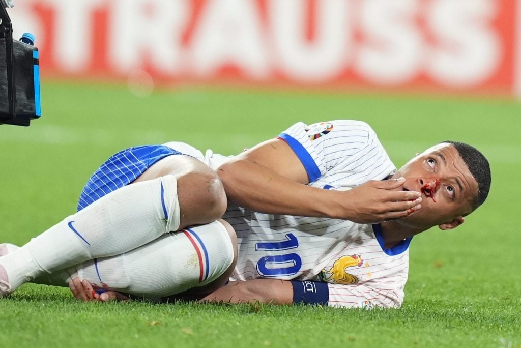 Mbappé si è rotto il naso dopo una botta tremenda: è completamente ...
