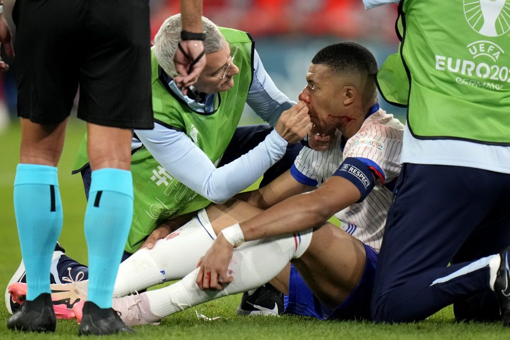 Mbappé rischia di rompersi di nuovo il naso se non recupera bene ...
