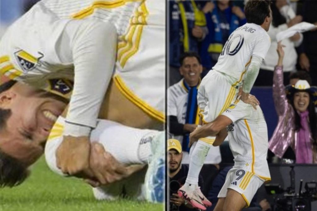 Riqui Puig mostra l'impressionante stato delle sue gambe dopo il grave ...