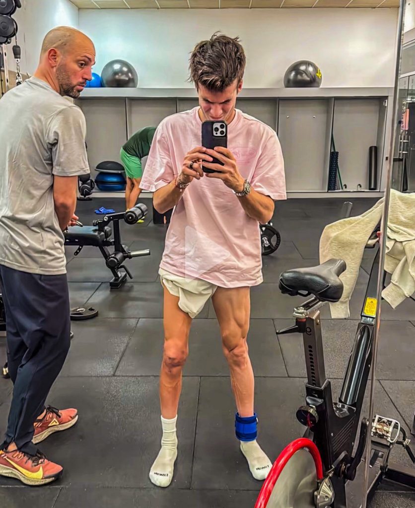 Riqui Puig mostra l'impressionante stato delle sue gambe dopo il grave ...