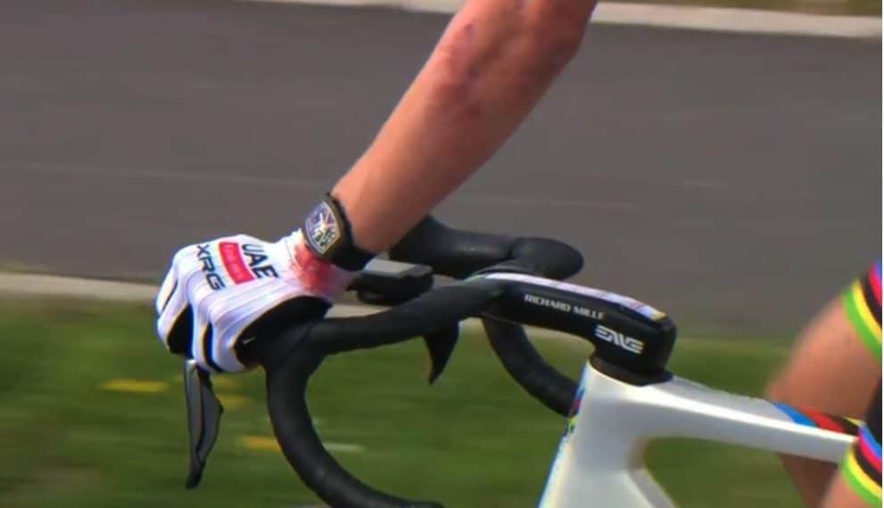 Pogacar aveva il guanto sporco di sangue alla Parigi-Roubaix: ferito ...