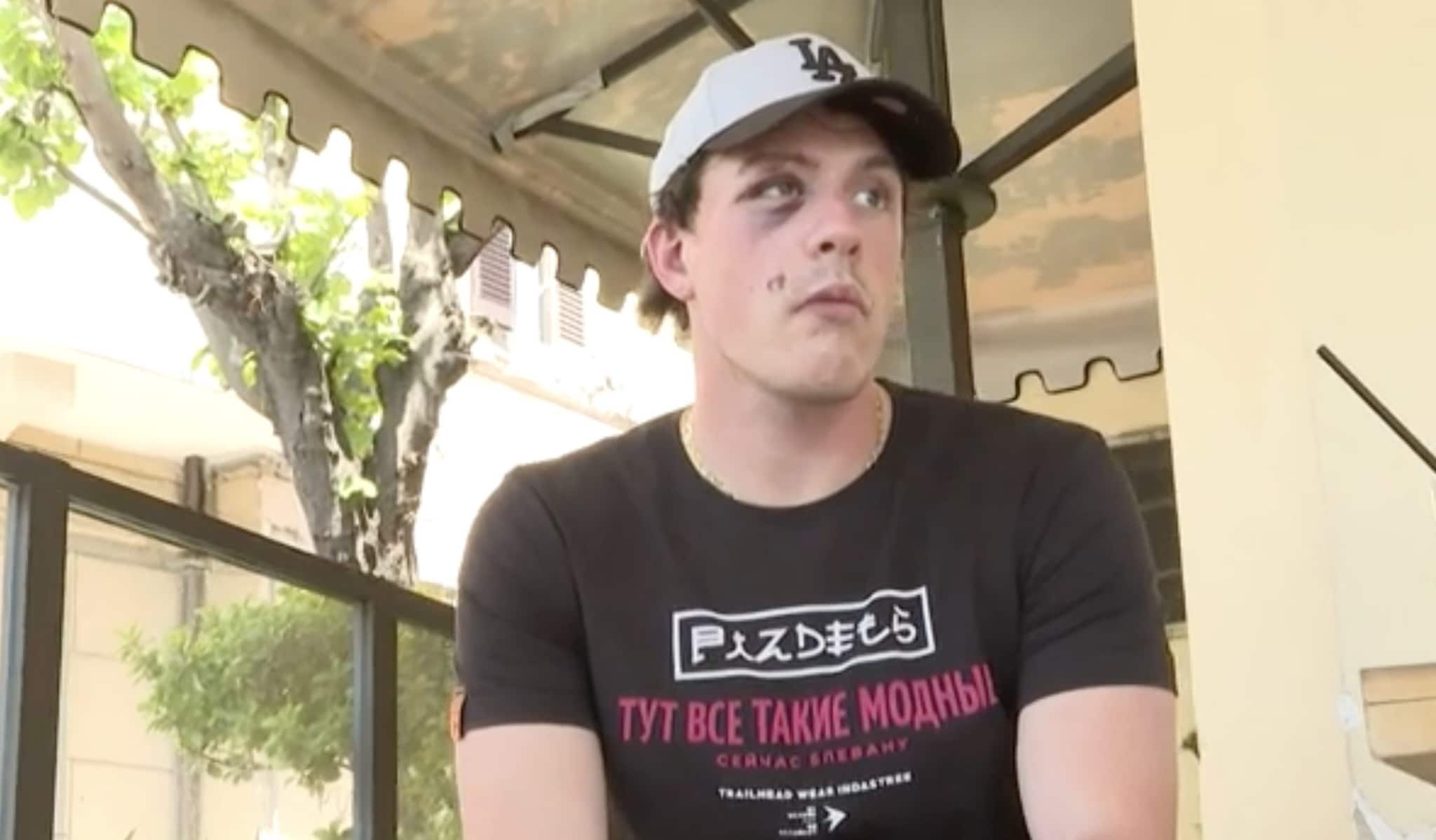 Michael massacrato di pugni e botte in un bar a Roma: "Ho difeso una ...