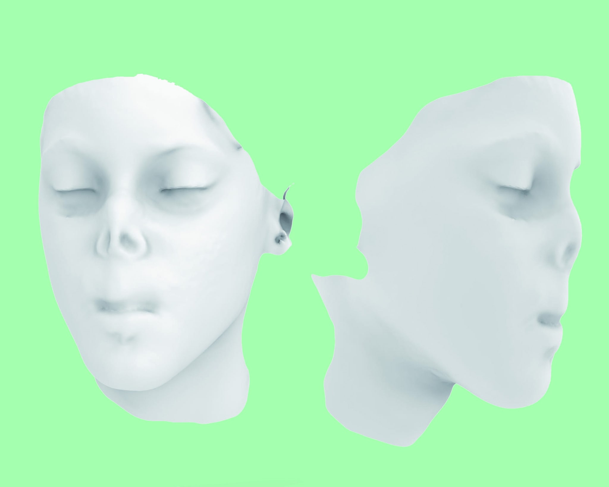 Bimbo morso da un animale perde naso e bocca: straordinario intervento ...