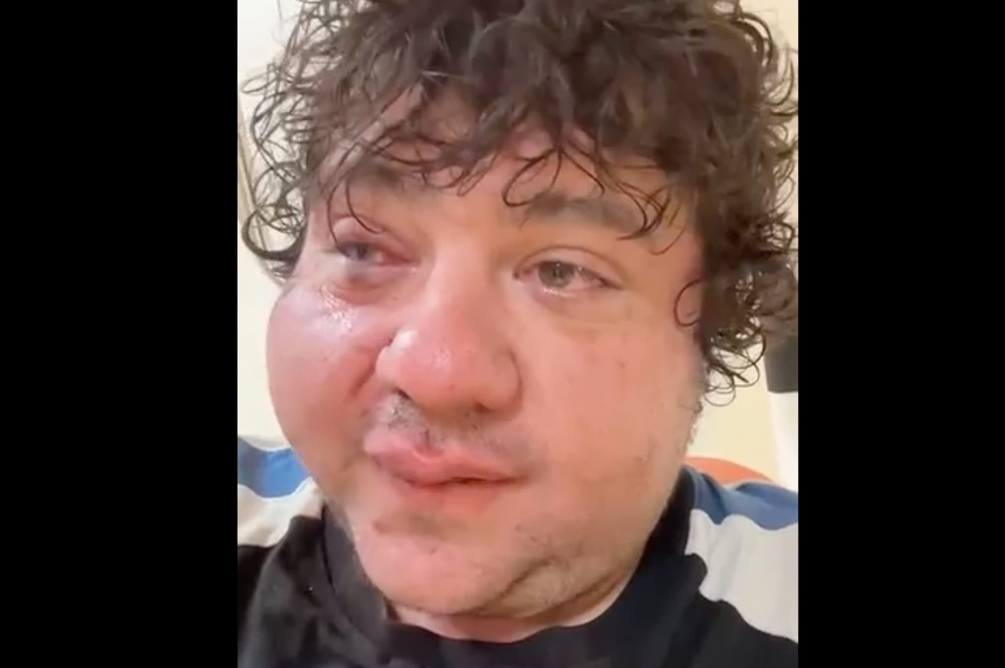 Il rapper Ozymandias picchiato dal branco a San Lorenzo: "Mi hanno ...