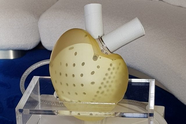 Impianto per la prima volta a Milano un cuore artificiale: sostituisce ...
