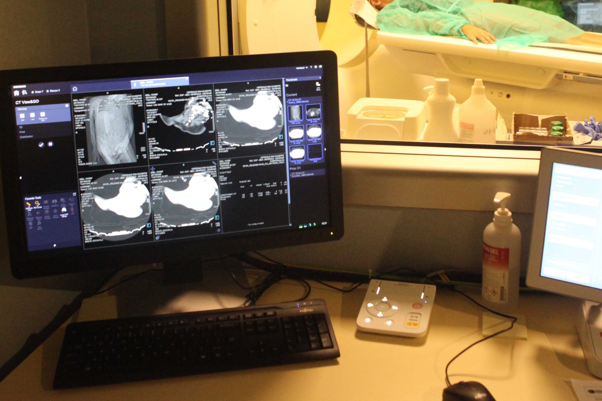 L'ospedale di Chiavenna non ha più radiologi: da Palermo ne mandano a ...
