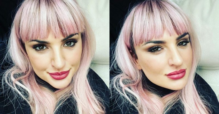 Arisa fresca come una rosa grazie al Thermage: in cosa consiste il ...