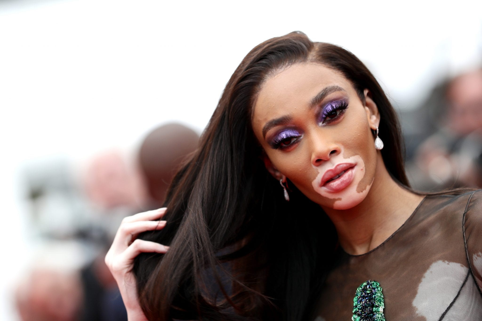 Giornata della vitiligine: da Winnie Harlow a Kasia Smutniak, le star ...