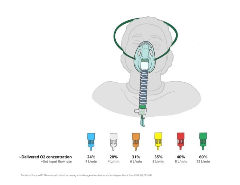 Cos’è Ventimask, la maschera usata per l’ossigenoterapia di Papa ...