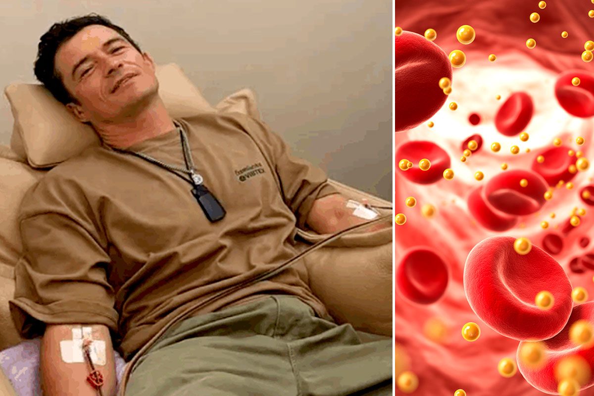 Il trattamento di Orlando Bloom per pulire il sangue dalle ...